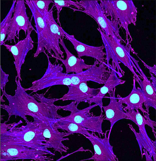 Fluorescence Microscopy